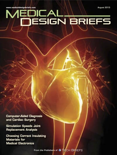 New MRI Technique for MS Research - Medical Design Briefs