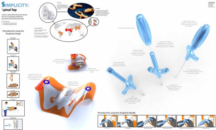 New Spinal Tap Kit for Improved Accuracy and Accessibility.