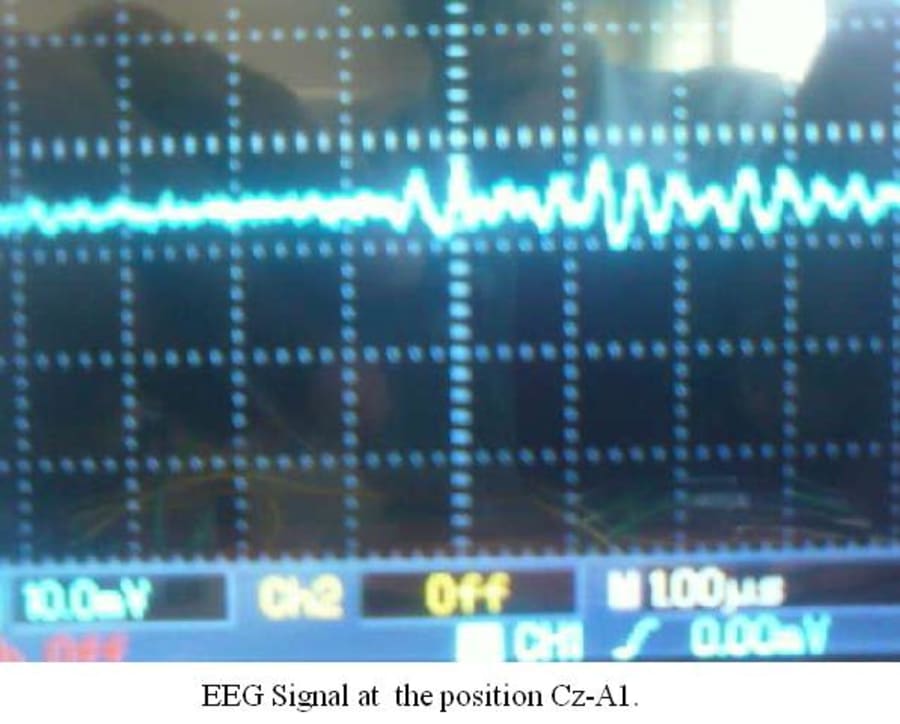 A Real Time Measurement of EEG Signal