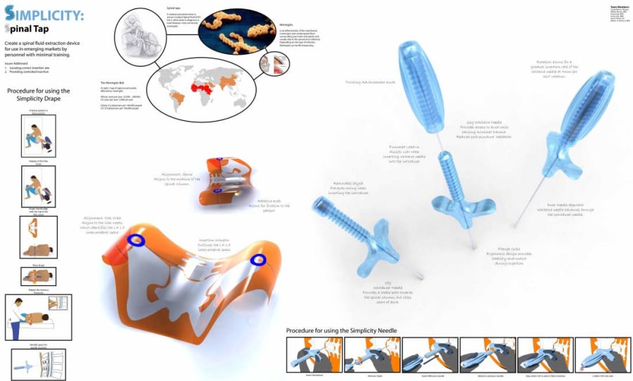 New Spinal Tap Kit for Improved Accuracy and Accessibility.