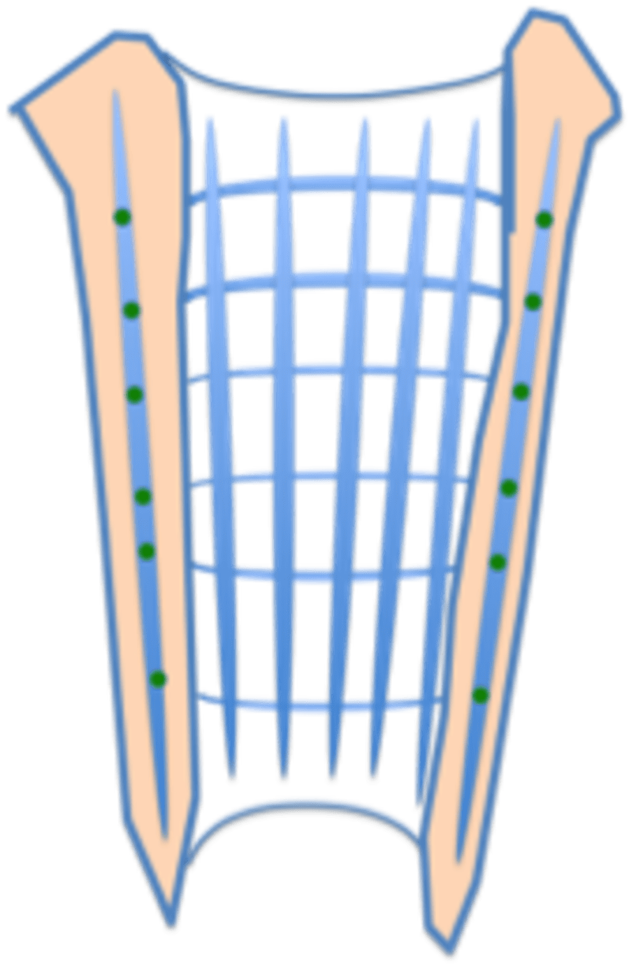 Physiologically Adaptive Prosthetic Sockets for Optimized Function and ...