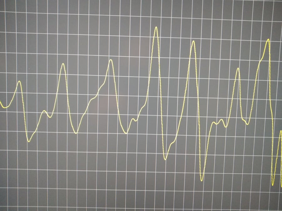 High-Occupancy Vehicle (HOV) Lanes