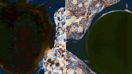 Coating Helps Implants and Bone Bond Better - Medical Design Briefs