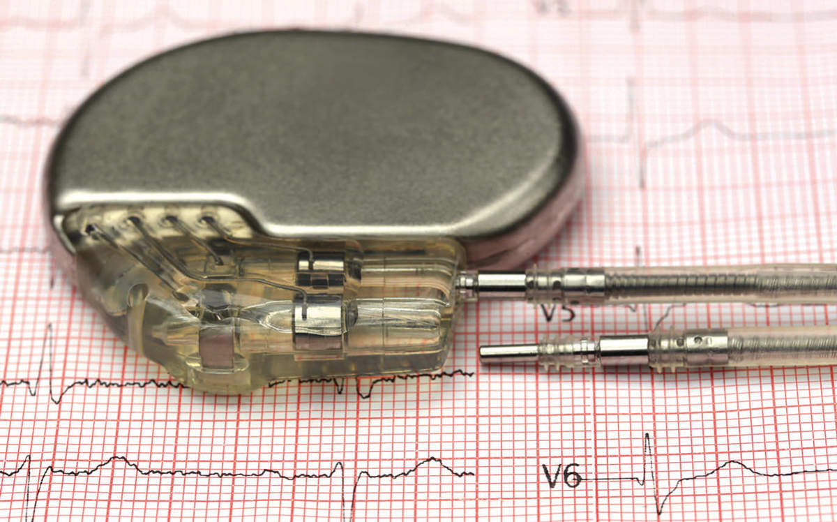 Nano Diamond Battery Provides Universal Applicability - Tech Briefs