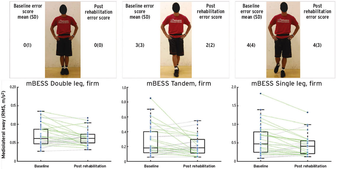 Sensory Integration Balance Deficits in Complex mTBI: Can Early ...