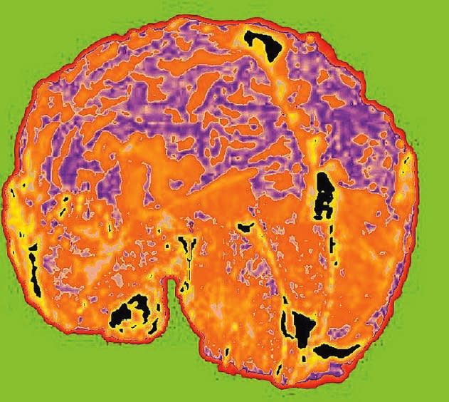 NASA-Developed Software Improves Diagnostic Imaging - Medical Design Briefs