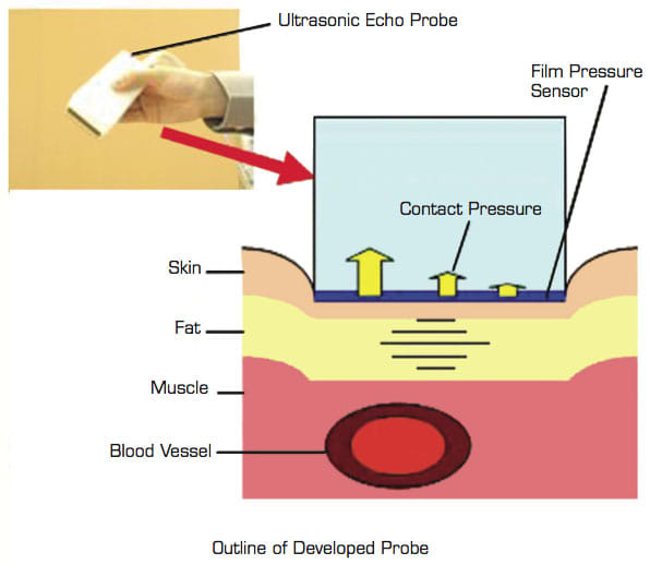 Ultrasonic Echo Probe With Measurement of Contact Pressure Distribution ...