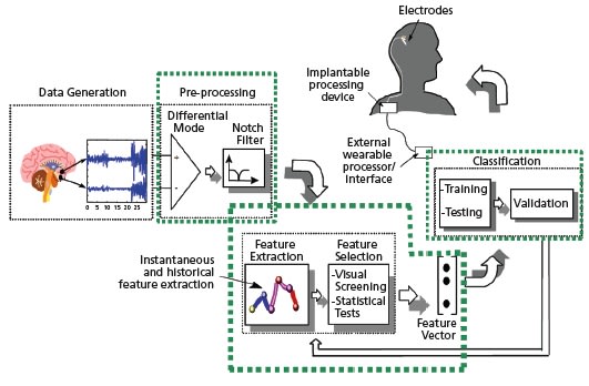 Engineering Devices to Treat Epilepsy - Medical Design Briefs