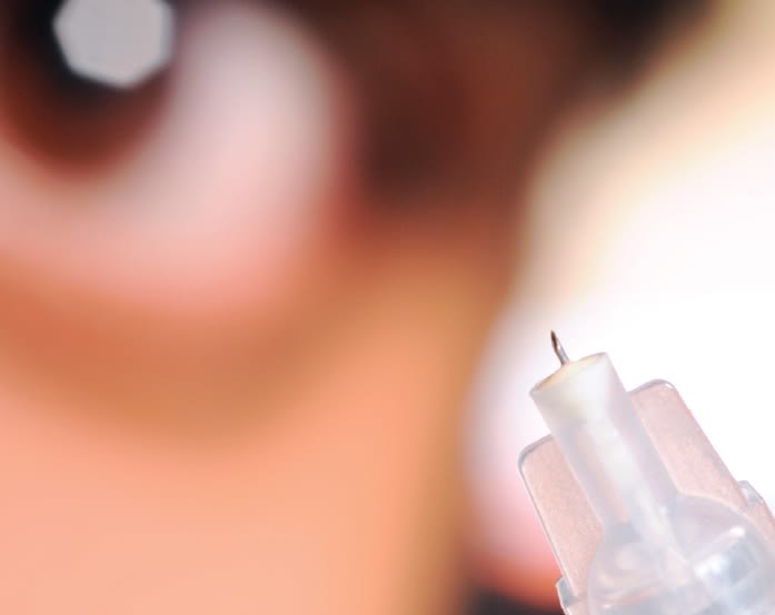 Microneedle Injection: Drug Delivery Targeted to the Back of the Eye ...