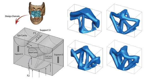 Engineering a New Face After Craniofacial Injury - Medical Design Briefs