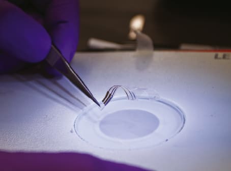 Implantable Electronic Gripping Devices - Medical Design Briefs