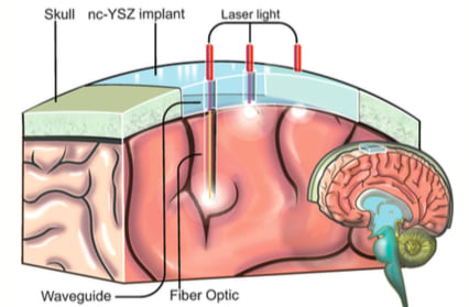 Therapeutic Window to the Brain - Medical Design Briefs