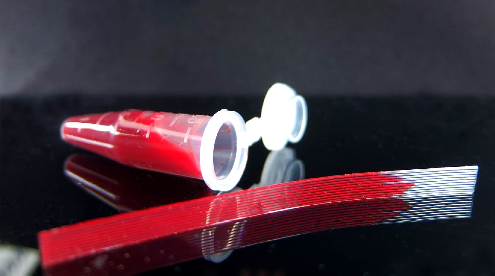 Miniaturized 'Lab-on-a-Stick' Detects Antibiotic Resistance - Medical ...