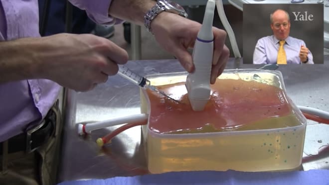 Yale Startup 'Advances' Guidewire Placement - Medical Design Briefs