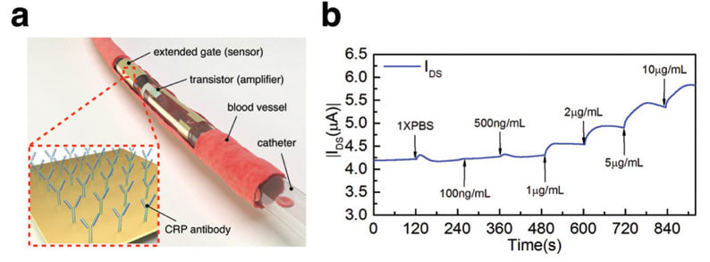 Real-Time Ultraflexible Sensor Improves Inflammation Testing - Medical ...
