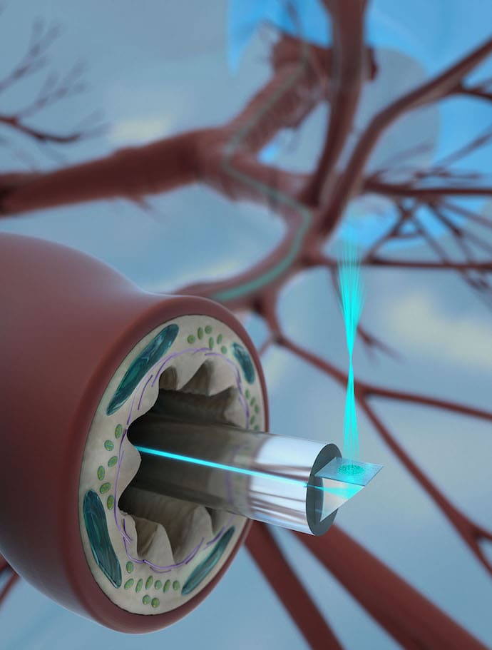 Nano-Optic Endoscope Sees Deep into Tissue - Medical Design Briefs