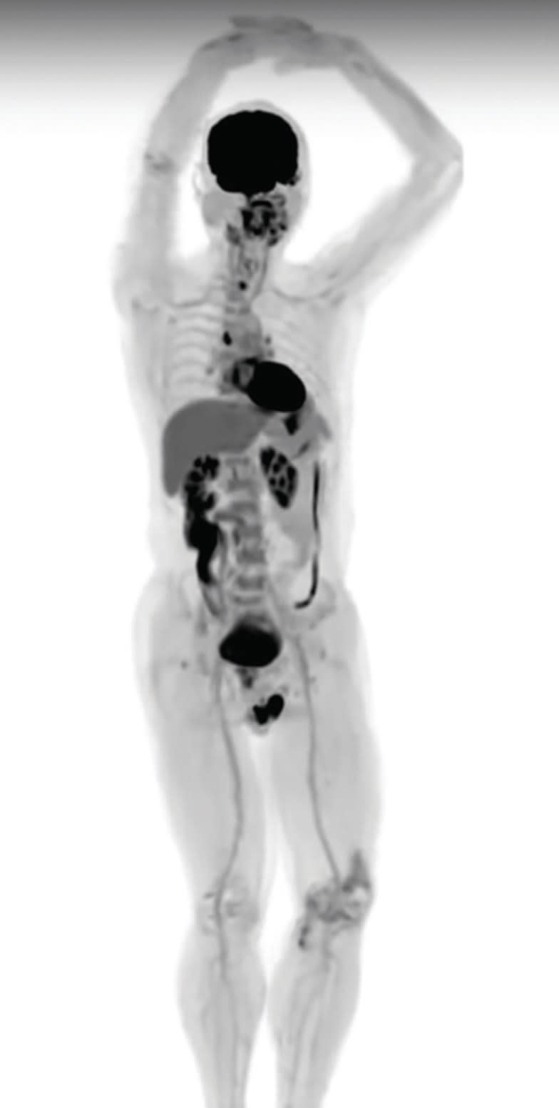 Human Images from World's First Total-Body Medical Scanner Unveiled ...