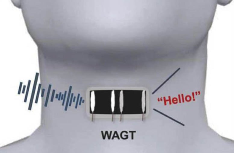 Artificial Throat Helps Mute Speak - Medical Design Briefs
