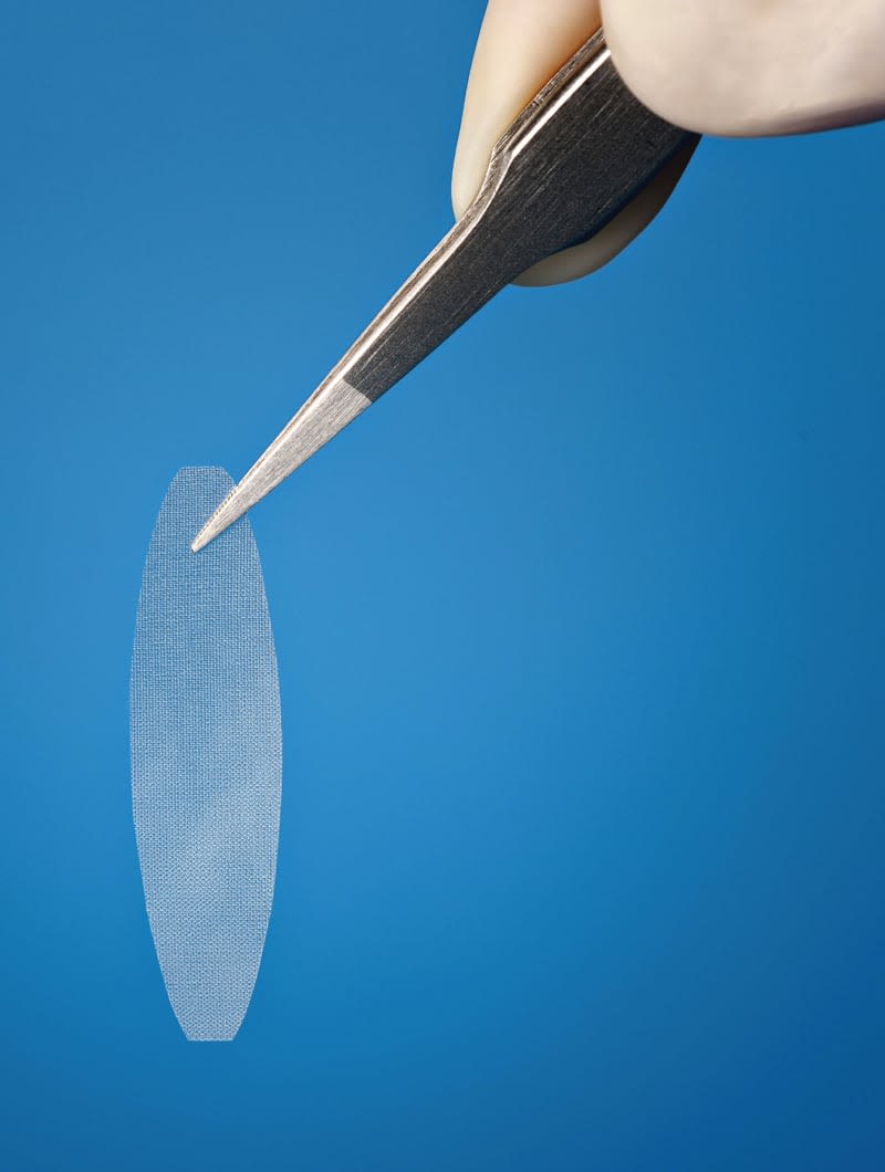 Bioresorbable Patch Offers New Alternative for Arterial Healing ...