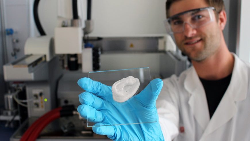 3D Printed Implants Created from Biodegradable Material - Medical ...