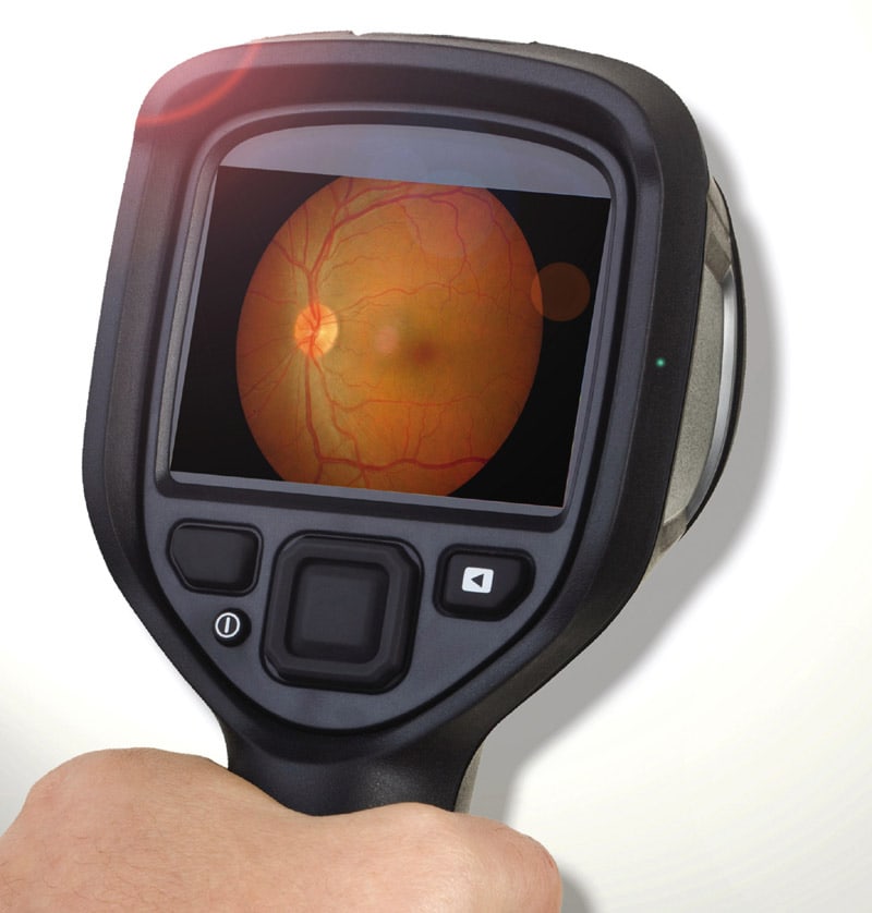 Embedded Computer Computer Vision in Medical Technology: Focus on ...