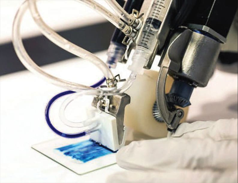 Handheld 3D Skin Printer Demonstrates Accelerated Healing of Large ...