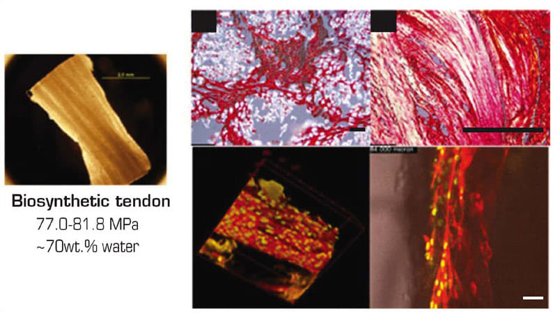 Synthetic Material Could Help Heal Injured Tendons and Ligaments ...