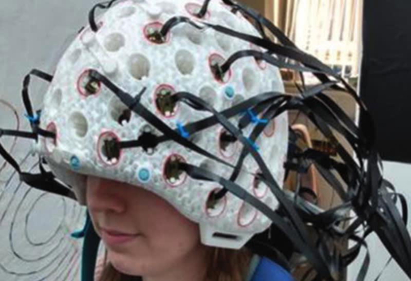 Wearable Brain Scanner for Whole Head Imaging - Medical Design Briefs