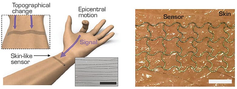 Deep-Learned E-Skin Decodes Complex Human Motion - Medical Design Briefs