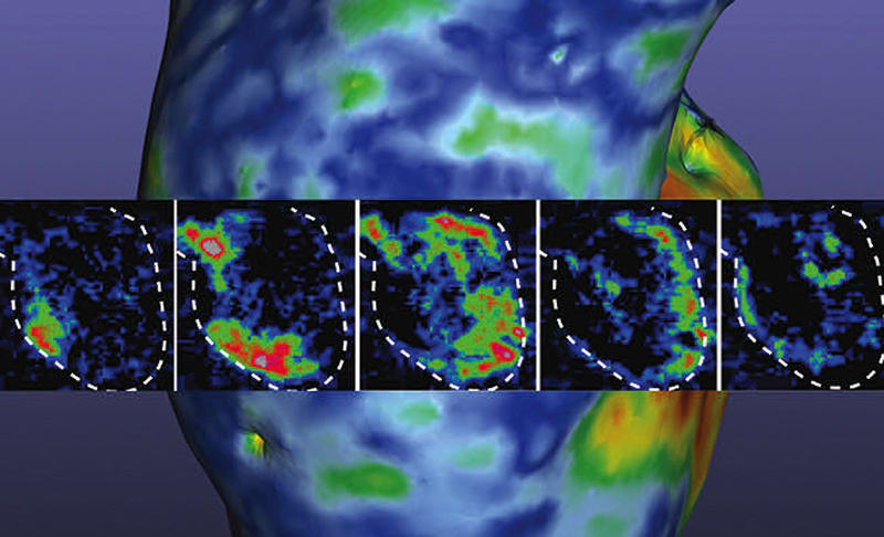 Researchers 3D Print Working Heart Pump with Human Cells - Medical ...