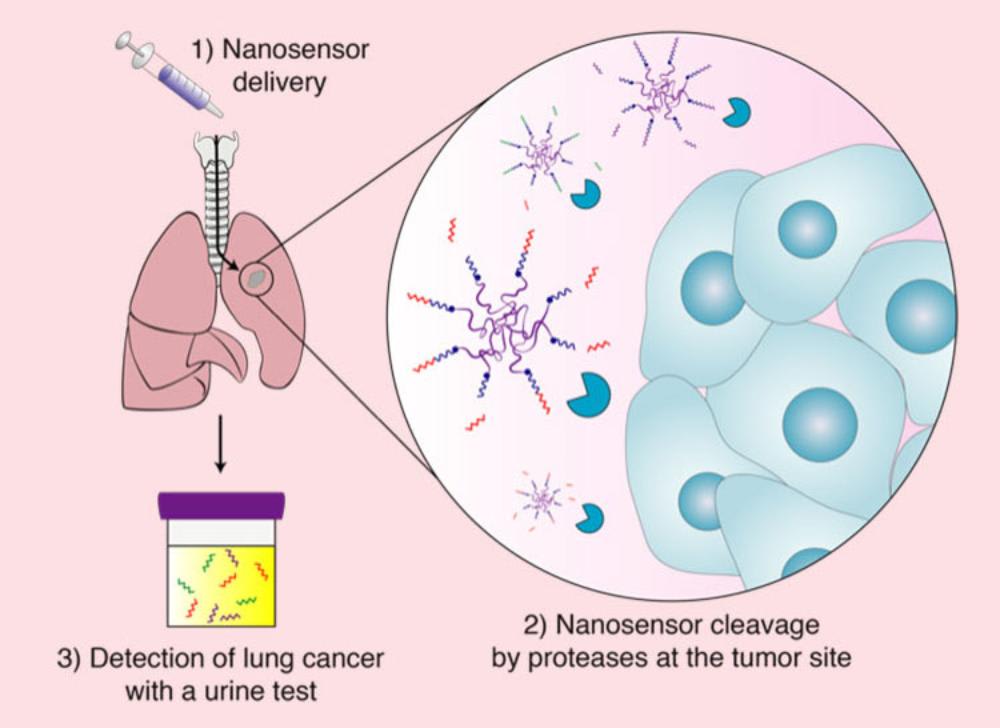 Sensors Offer Early Detection of Lung Tumors - Medical Design Briefs