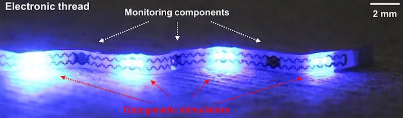 Smart Wrap Implant Helps Bladder Control - Medical Design Briefs