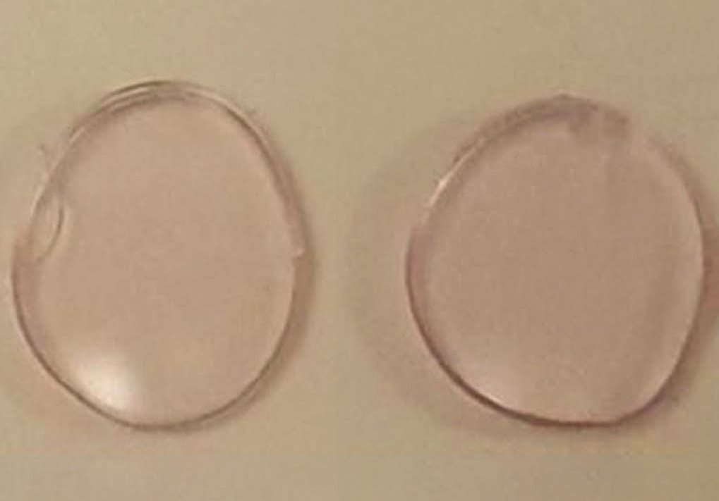 Color Blindness-Correcting Contact Lenses - Medical Design Briefs