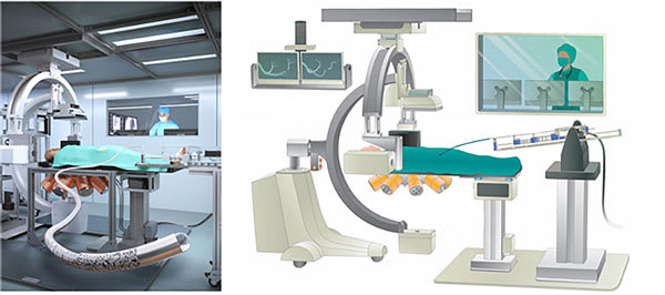 Robotic System Uses Magnetic Field to Treat Blood Vessels - Medical ...