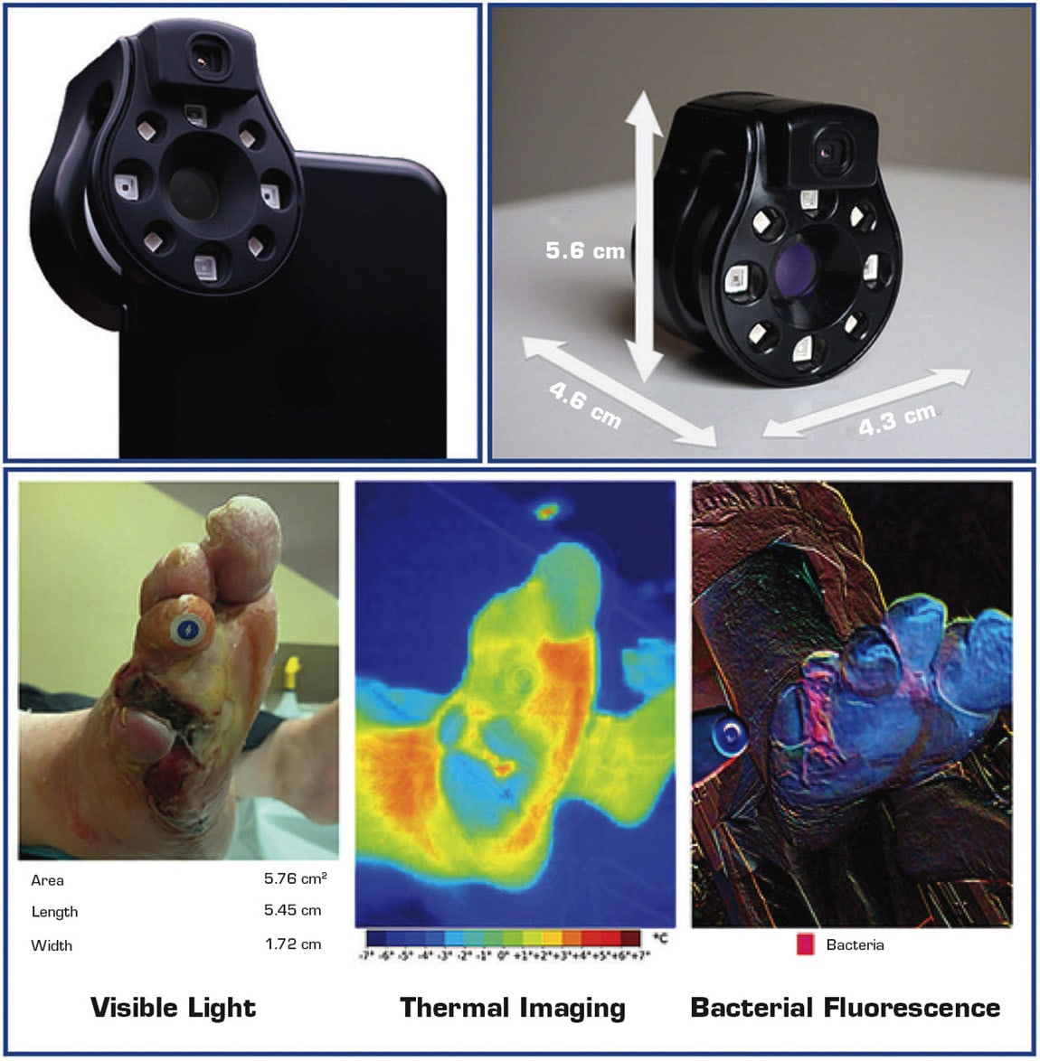 Pocket-Sized Device Could Spot Infected Wounds Faster - Medical Design ...