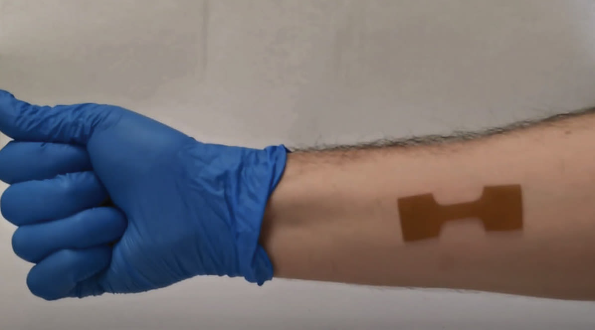 Programmable 3D Printed Wound Dressing Improves Treatment for Burn ...
