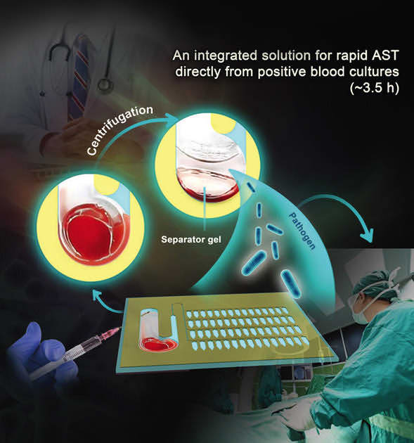 Microfluidic Chip Tests Drug Sensitivity - Medical Design Briefs