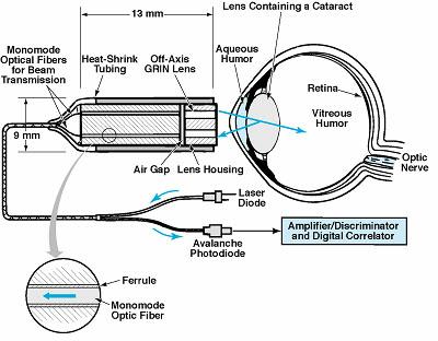 Compact, Noncontact Fiber-Optic Probe for Diagnosis of Eye Diseases ...