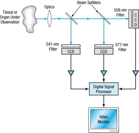 Imaging System Shows Ischemic Regions - Tech Briefs