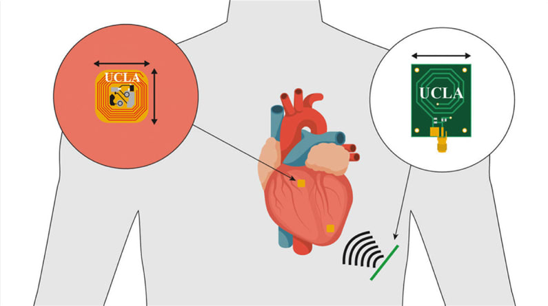 Wirelessly Powered, Leadless Pacemaker - Tech Briefs