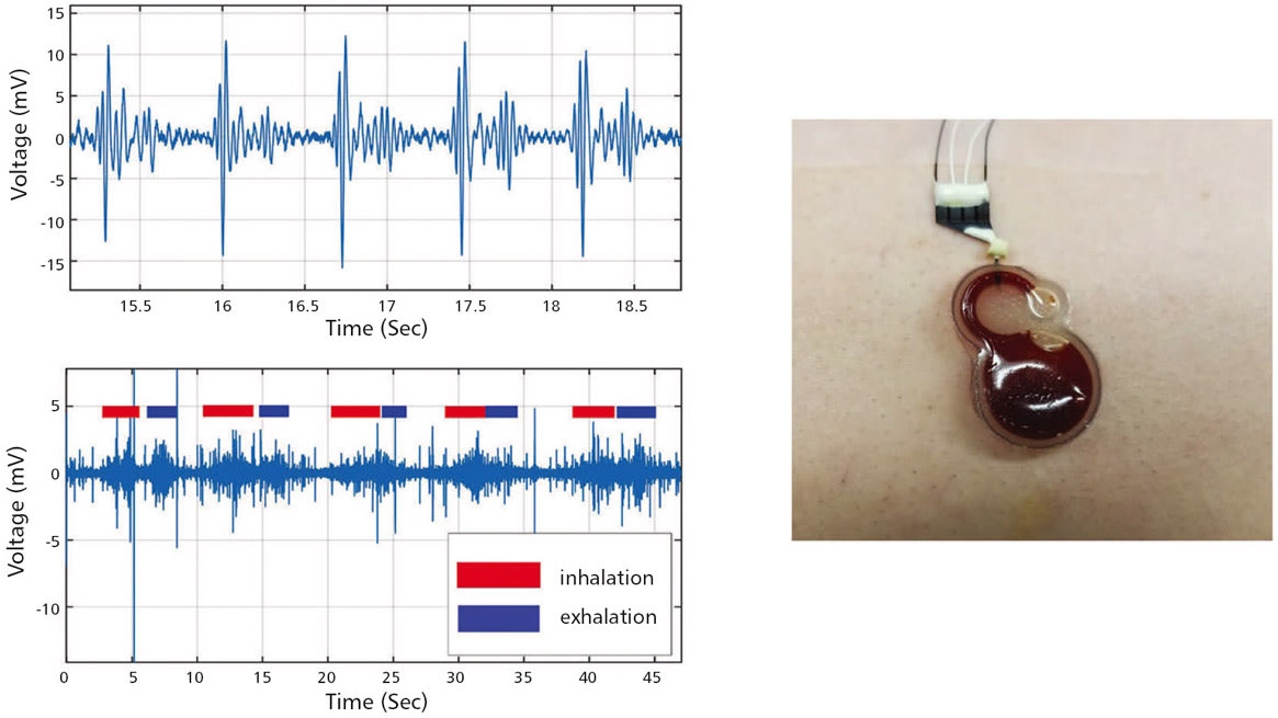 Wearable Electronics for Continuous Cardiac, Respiratory Monitoring ...