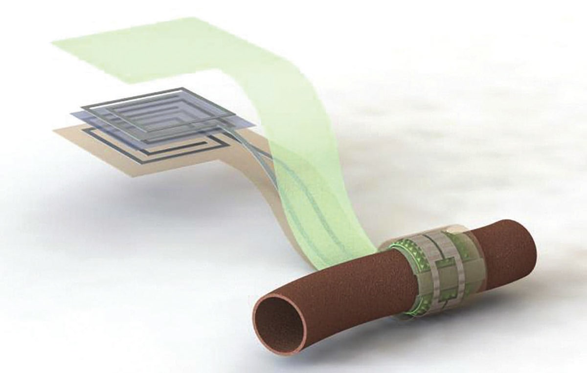 Wireless, Battery-Free, Biodegradable Blood Flow Sensor - Tech Briefs