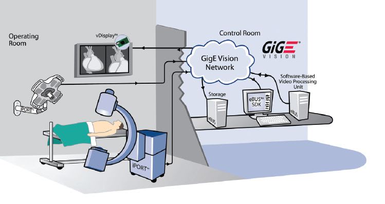 The GigE Vision® Interface Standard: Transforming Medical Imaging ...