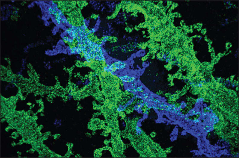 High-Resolution Imaging with Conventional Microscopes - Tech Briefs
