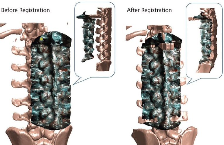 Imaging System Makes Back Surgery Safer, Faster, Less Expensive - Tech ...