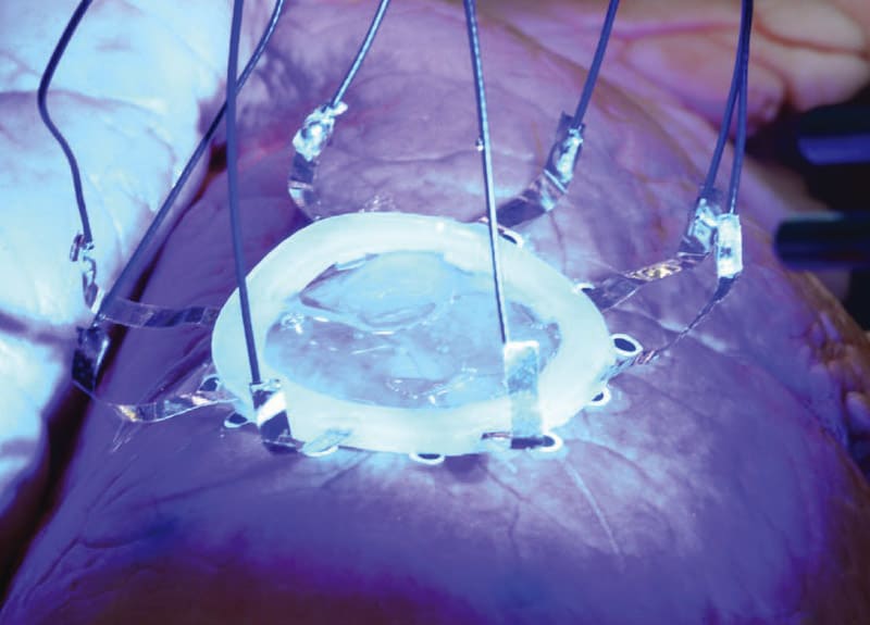 Engineers 3D-Print Sensors Onto Moving Organs - Tech Briefs