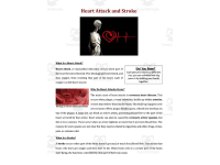 Heart Attack and Stroke - Science Reading Article - Grades 5-7 by Teach ...