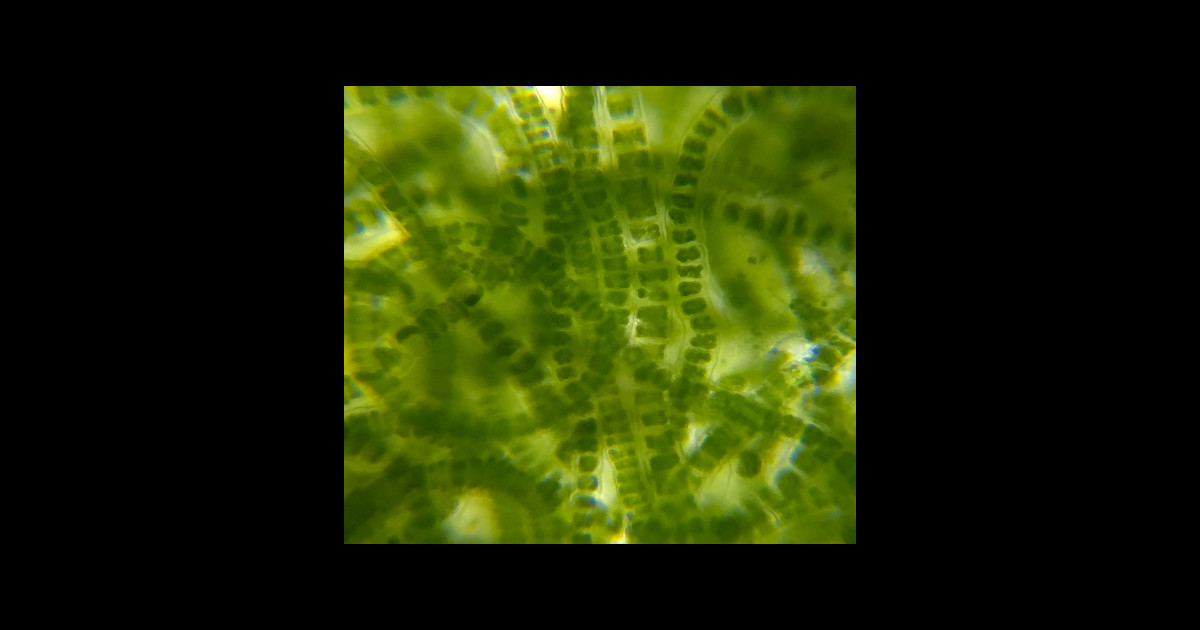 Green Microscopic Seaweed - Algae - Sticker | TeePublic