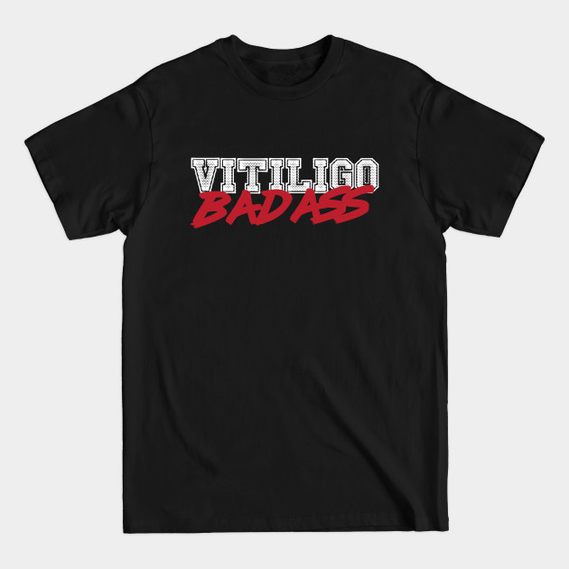 Vitiligo Bad Ass - Vitiligo - T-Shirt Designed & Sold By BilHicks