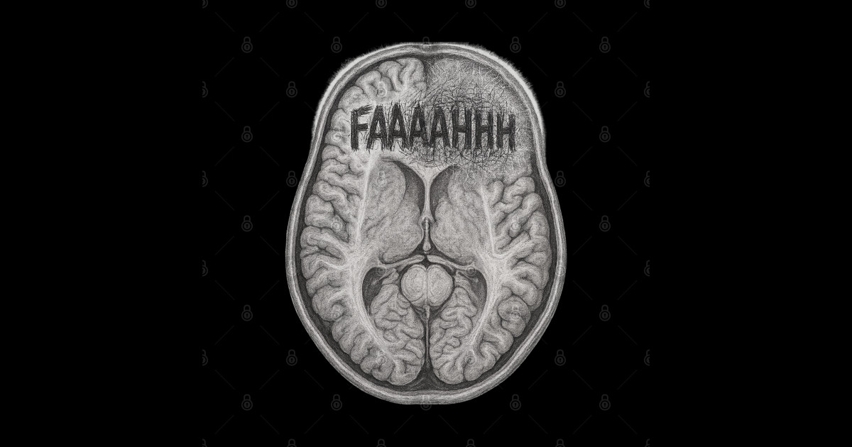 Ironic Brain MRI Meme Poster – “FAAAAHHH” Frontal Lobe Chaos - Ironic ...